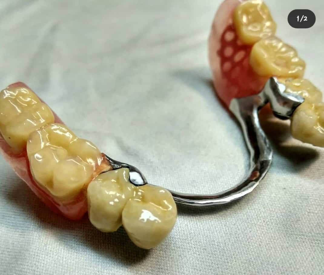 Prothese - Tandarts Verbeke Caroline